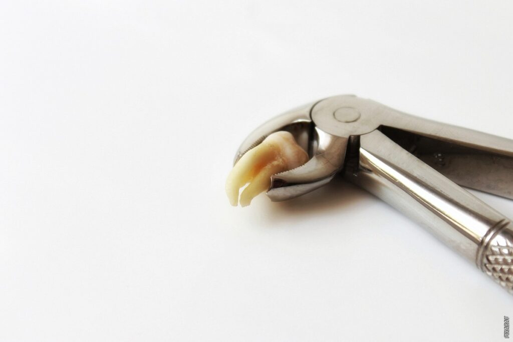 Koji je umnjak zub po redu - Susjed